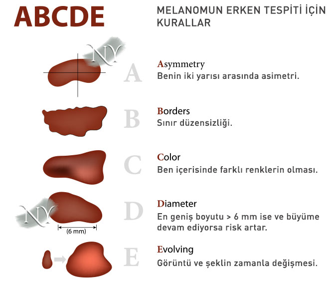 abcde kuralı nedir | kişisel şeyler
